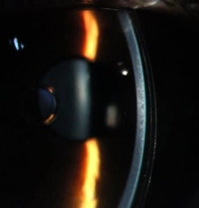 Eye Care Services » St. Clair Optometry